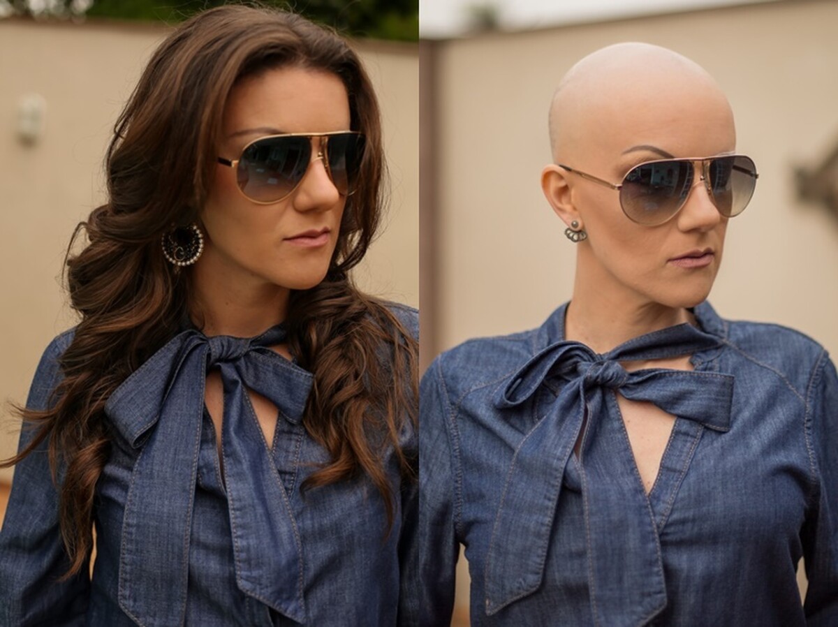 Foto: Ana Ávila mostra que é posssível deixar o aspecto bonito e saudável com a maquiagem ...