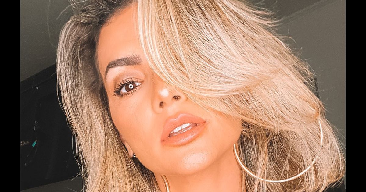 Kelly Key revelou nova parte do tratamento contra câncer de pele ...