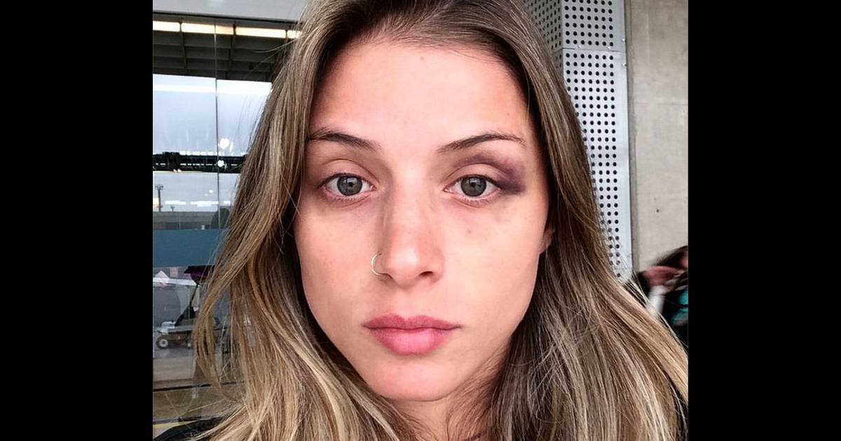 Há um ano, Angela Sousa acusou Yuri de agressão e o romance chegou ao ...