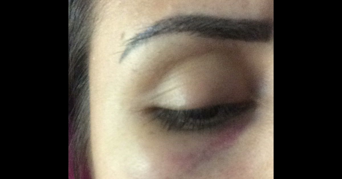 A suposta agressão teria causado olho roxo em Jéssica França - Purepeople