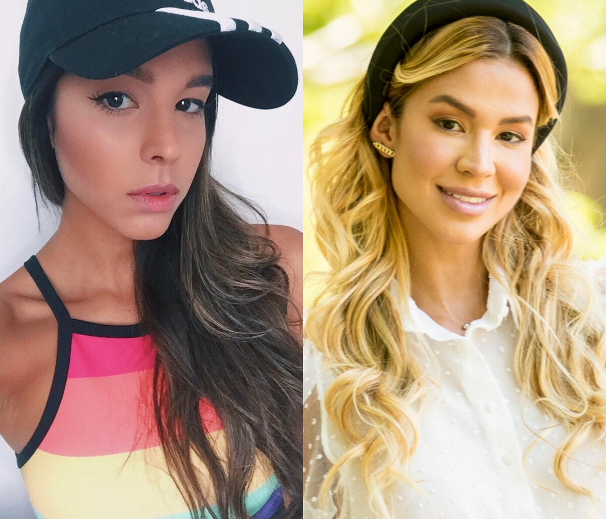 Foto: Kerline, do 'BBB21', passou por harmonização facial por ...