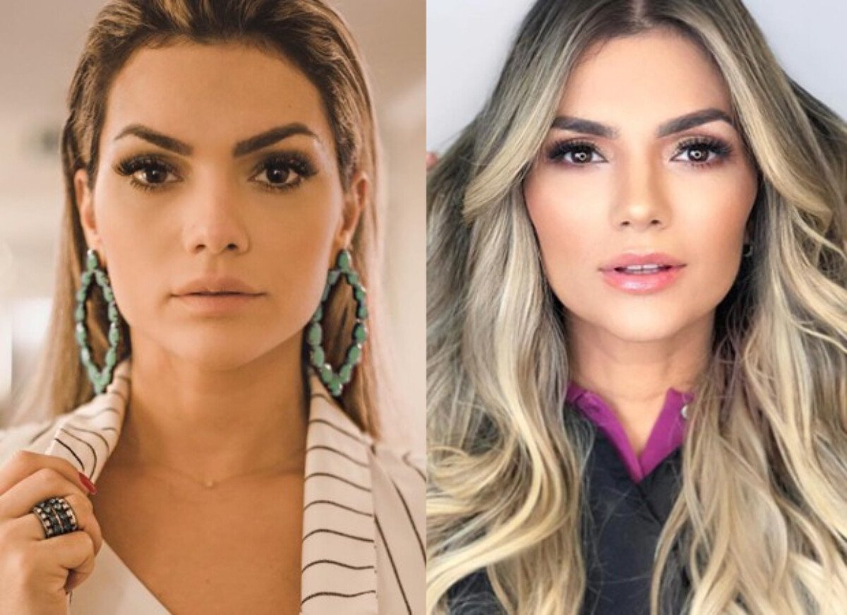 Foto: Antes e depois: Kelly Key fez harmonização facial e realçou seus ...