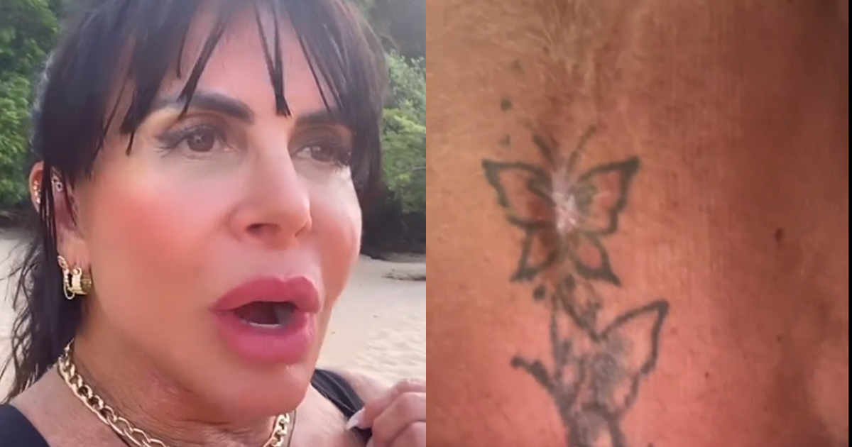 Gretchen: umbigo da cantora após procedimento estético é alvo de ...