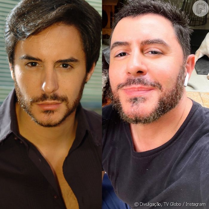 Veja o antes e depois de Ricardo Tozzi e compare! - Purepeople