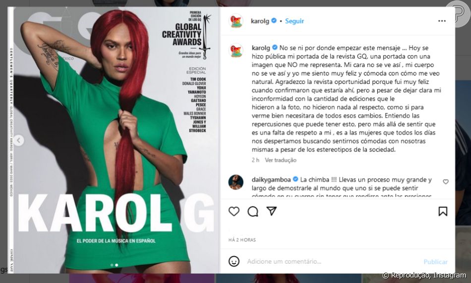 Aparência de Karol G em capa de revista assusta fãs e cantora se defende: 'Meu rosto não é assim ...