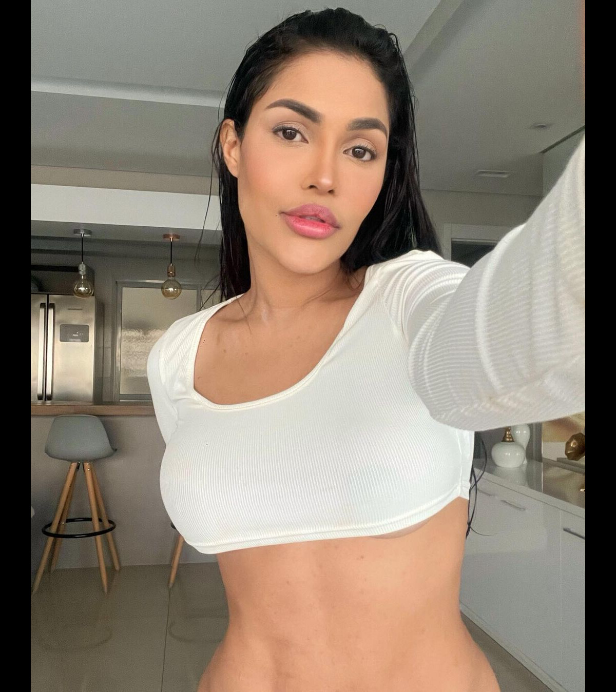 Foto Ex Bbb Flay Teve Problemas De Pele Após Chip Da Beleza Purepeople