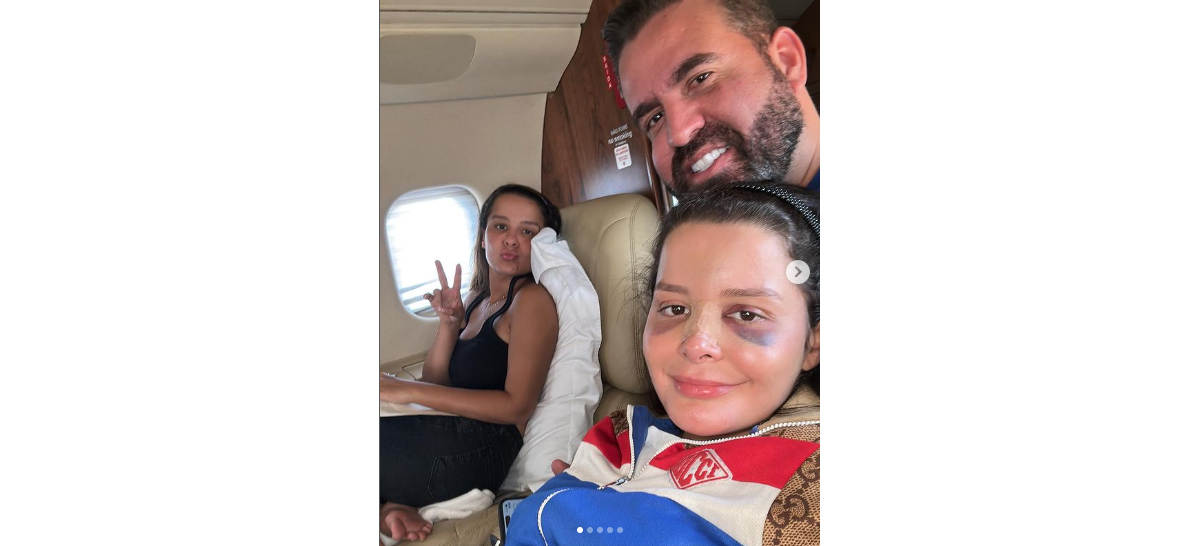 Foto: Maraisa mostrou o rosto machucado depois de acidente em jacuzzi ...