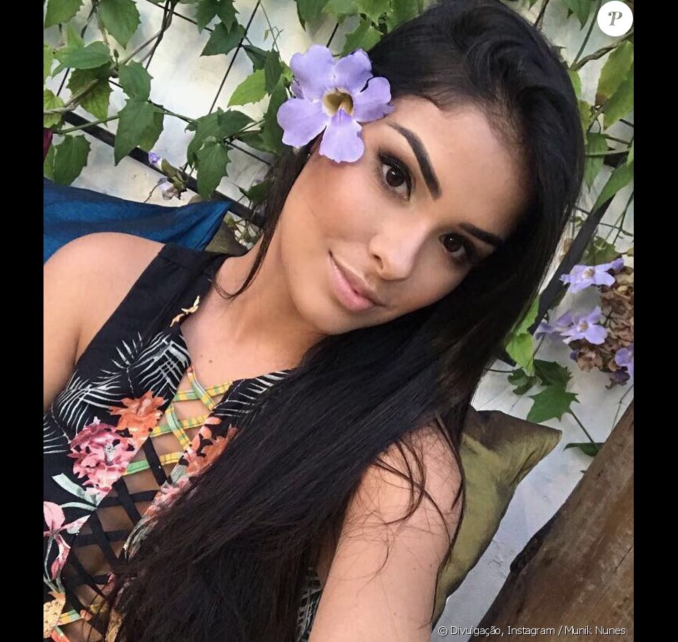 Ex-BBB Munik Nunes cancelou a lua de mel após cirurgia para retirar o ...