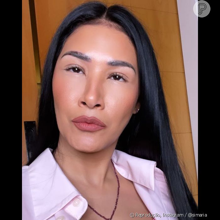 Simaria mostra rosto inchado após ser picada por abelha - Purepeople