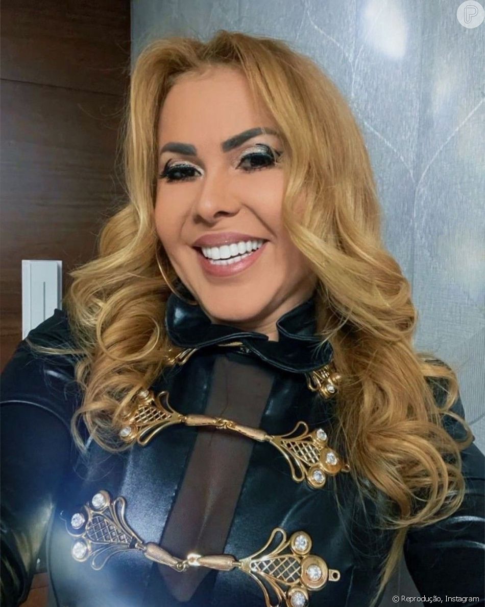 Rosto inchado de Joelma choca web: 'O que houve?'. Saiba o que ... Rosto inchado de Joelma choca web: 'O que houve?'. Saiba o que ...