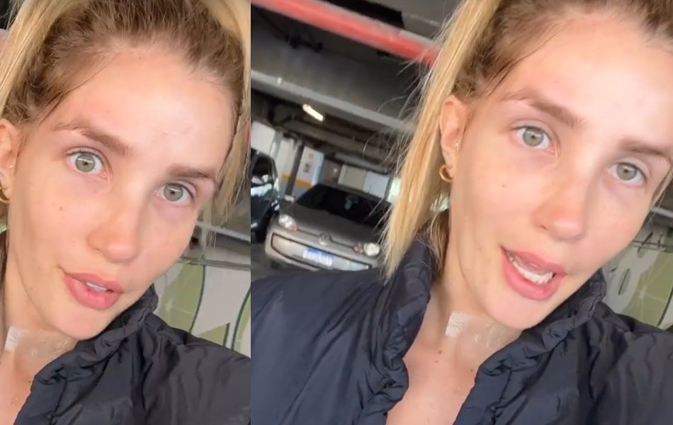 Aline Gotschalg antes e depois do câncer: ex-BBB revela tratamento após ...