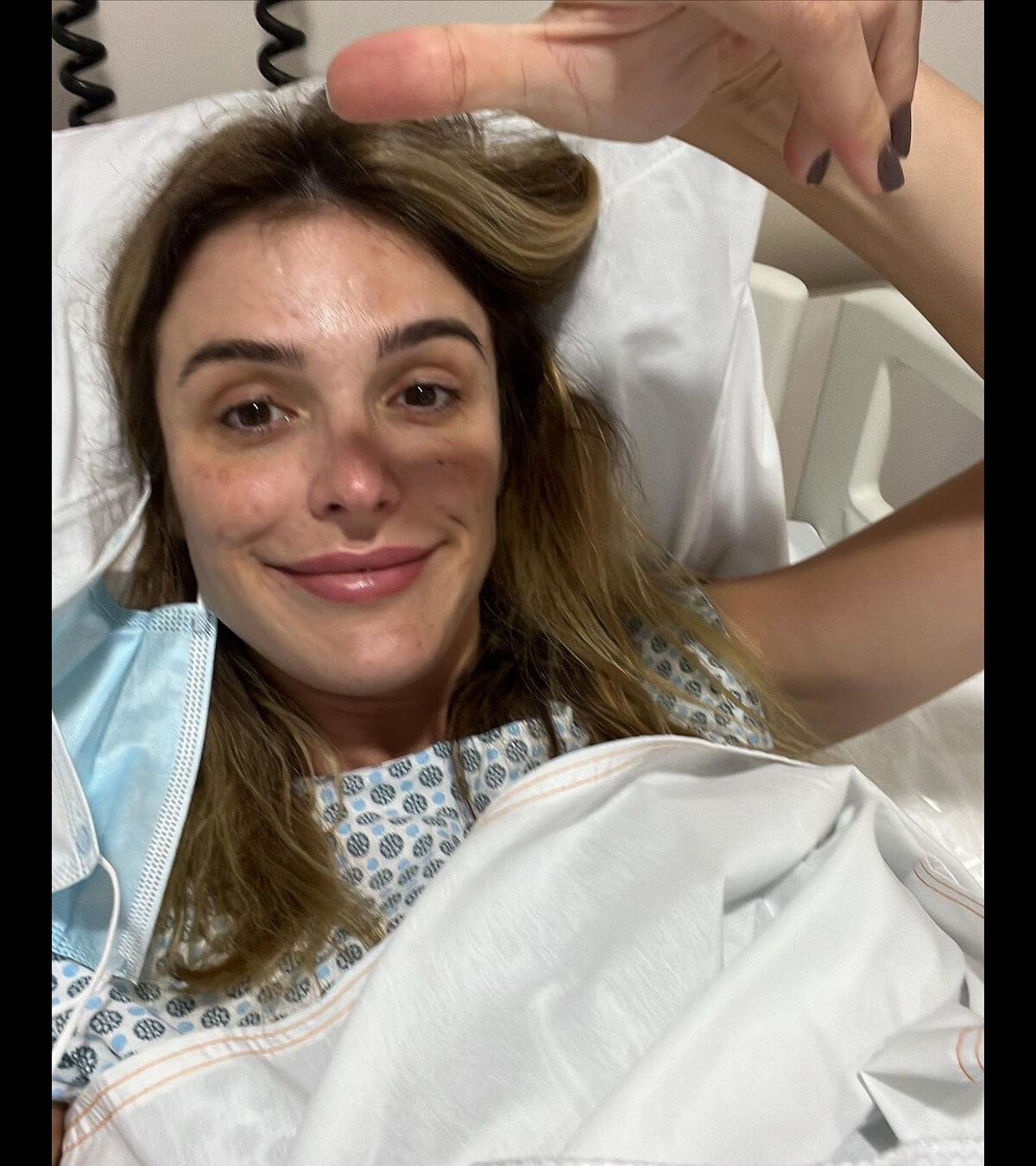 Foto: Rafa Brites passou por três procedimentos - Purepeople