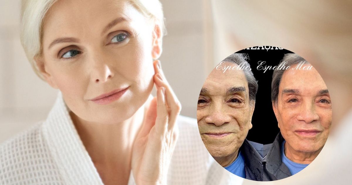 Harmonização facial: qual idade limite? Antes e depois de Dedé Santana ...
