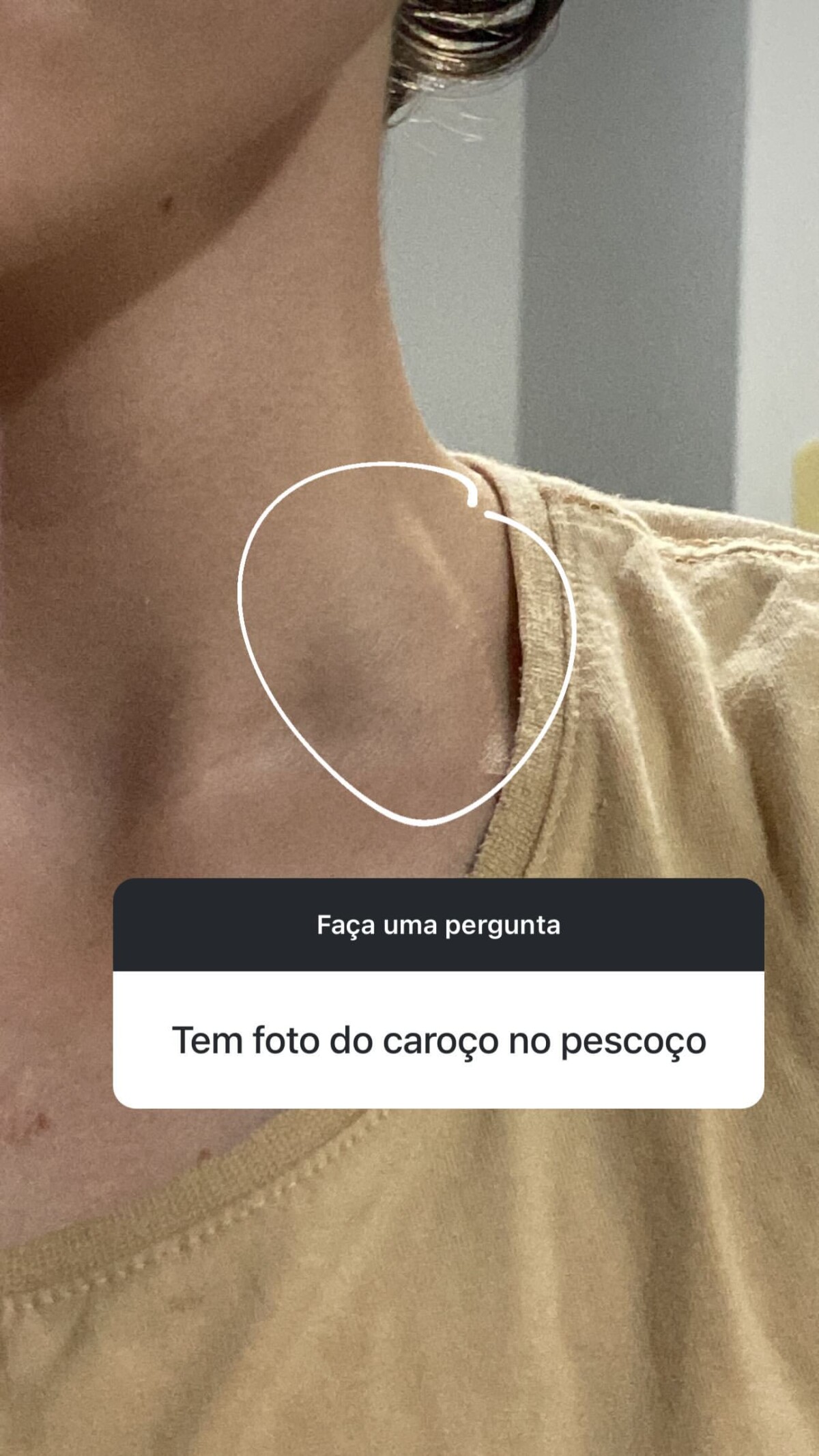 Foto: Isabel Veloso foi diagnosticada com câncer em 2021 e já passou ...