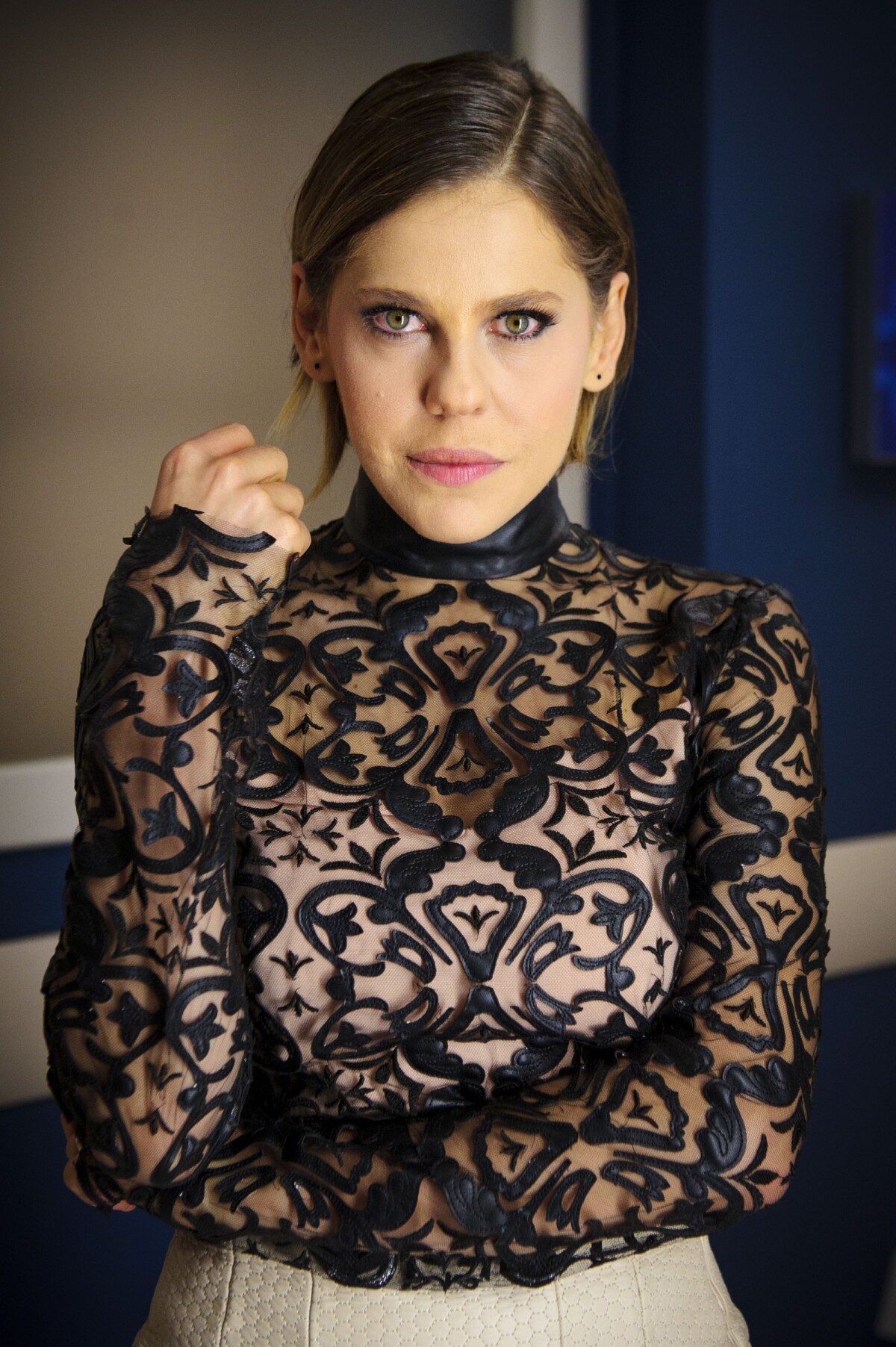 Foto: Bárbara Paz tem cicatrizes no rosto por causa de um acidente de ...