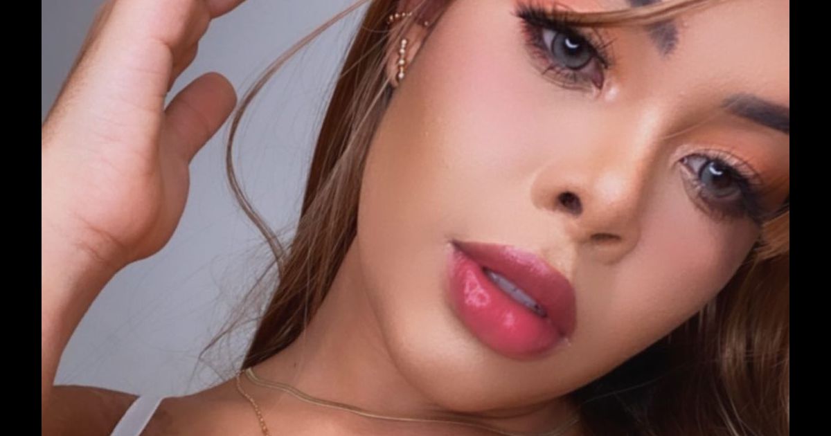 Influencer Sthefane Matos fez enxerto com pele da orelha e boca ...