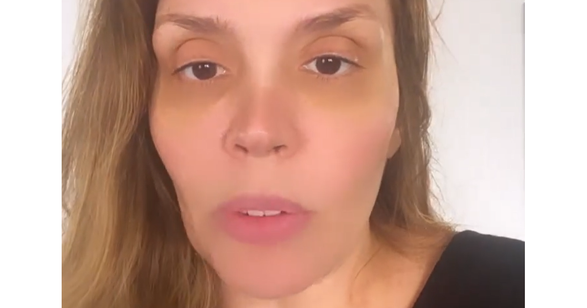 Simony, de 46 anos, usou as redes sociais para atualizar seu estado de ...