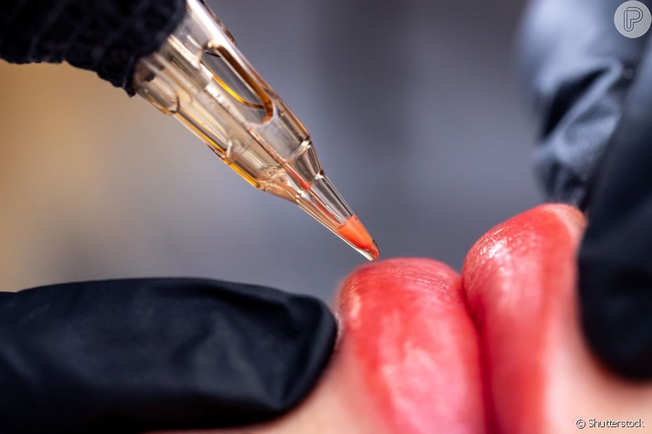 Preenchimento Labial Preço Como é Feito Durabilidade E Mais