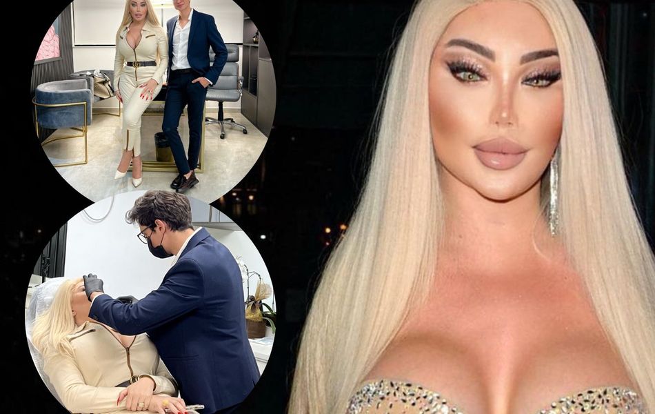 Ex Ken Humano Modelo Jéssica Alves Se Submete A Novos Procedimentos E