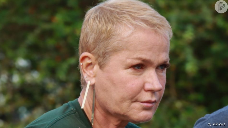 Xuxa Meneghel fez lipoaspiração e outro procedimento estético: saiba ...