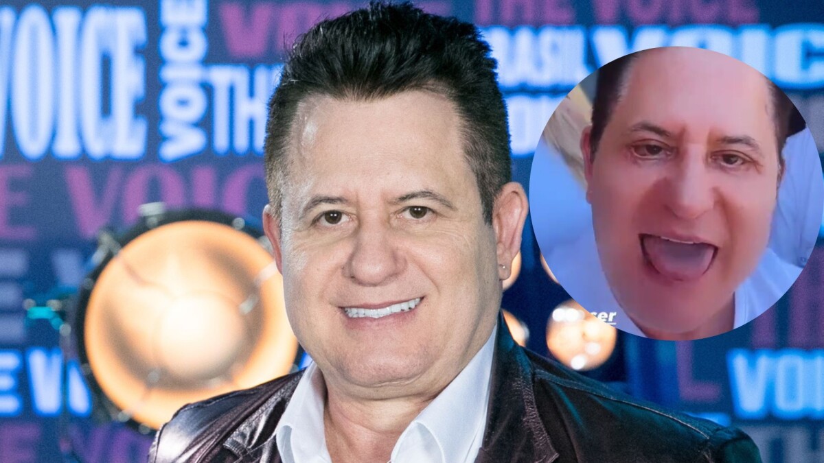 Foto: Marrone impressiona com resultado de cirurgias plásticas - Purepeople