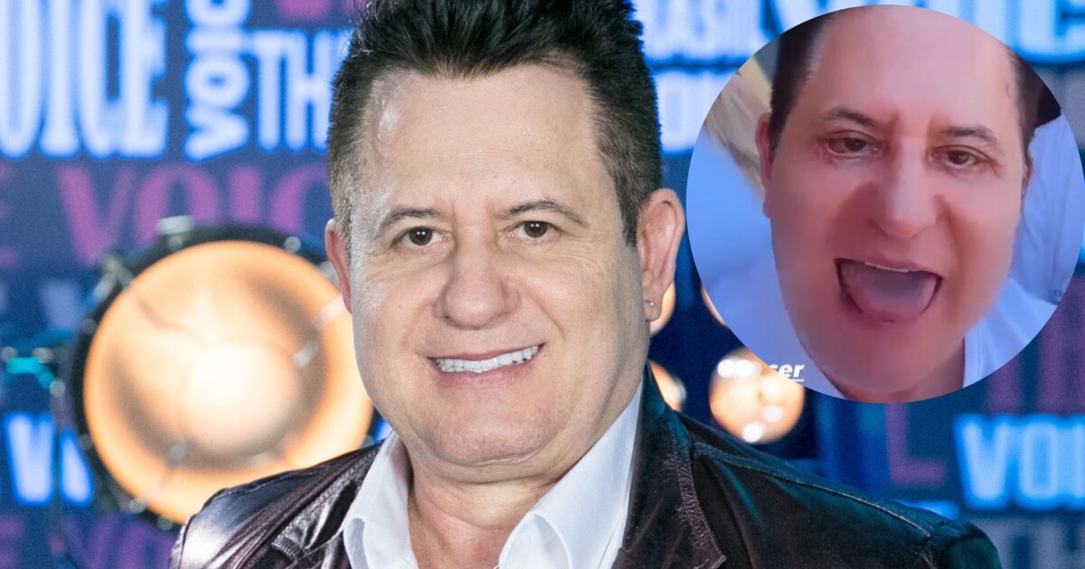 Marrone, da dupla com Bruno, se assusta após resultado de plástica no ...