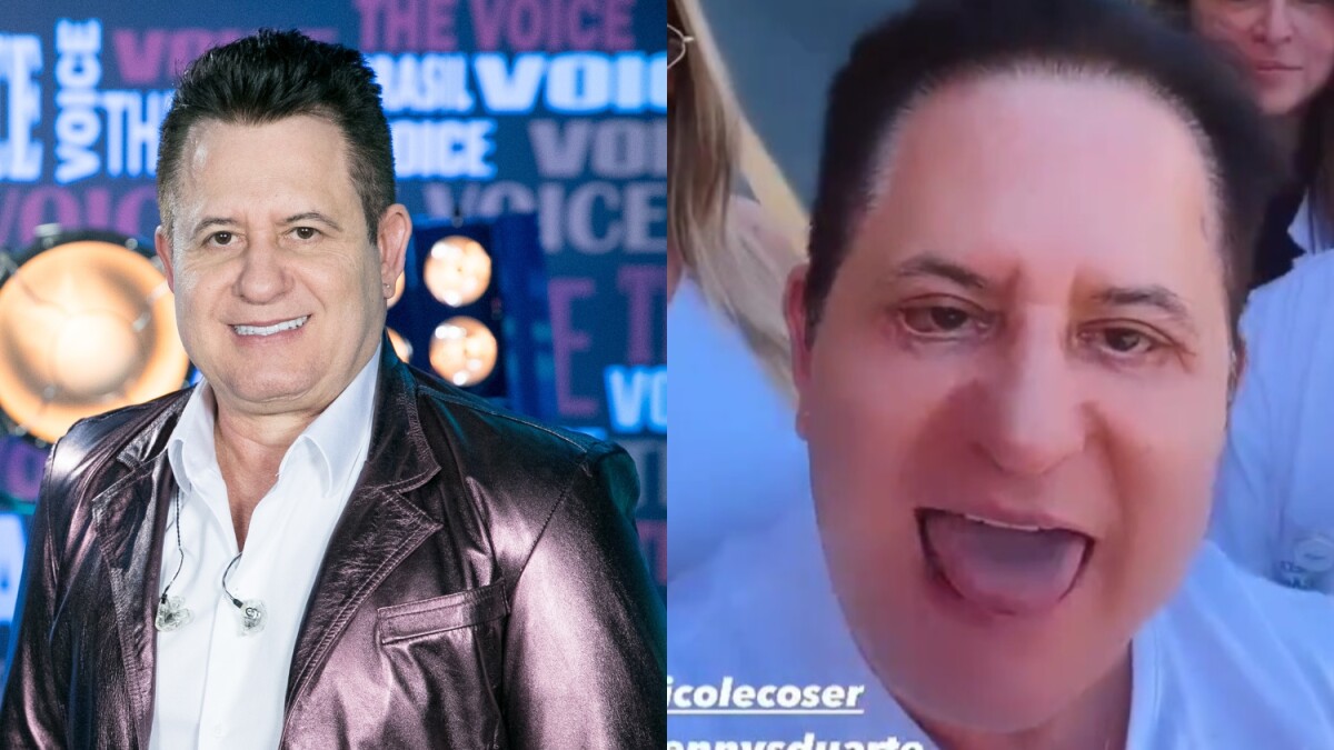 Foto: Antes e depois das plásticas de Marrone - Purepeople