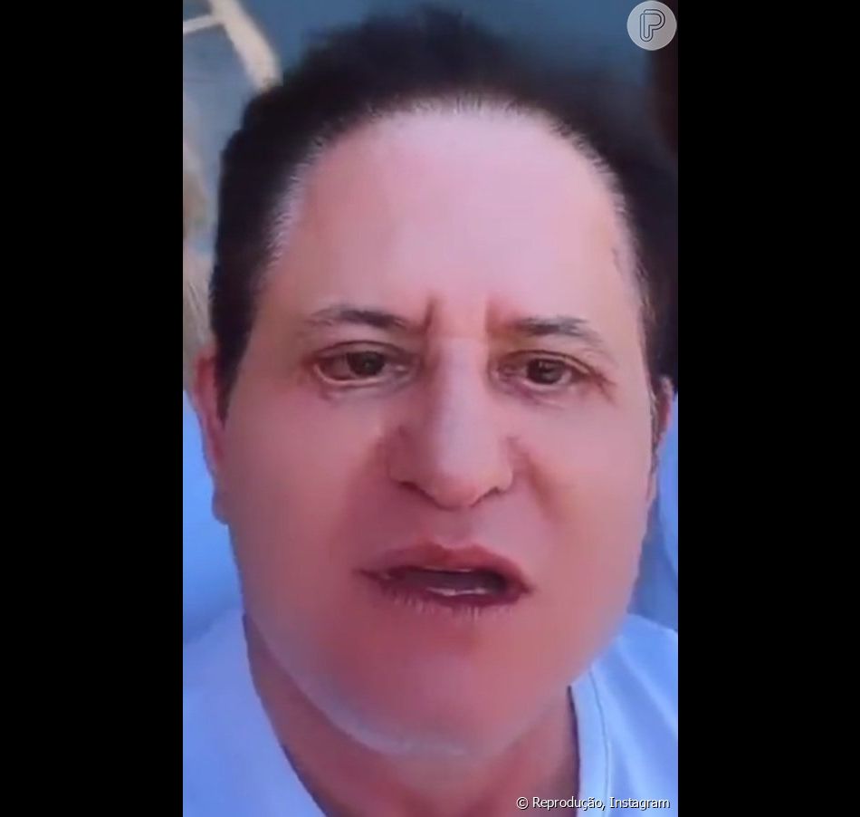 Marrone, dupla com Bruno, mostra antes e depois de cirurgia no rosto e ...