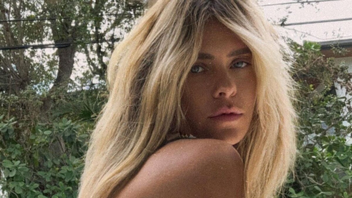 Foto: Carolina Dieckmann é detonada por cabelo ressecado, rugas no ...