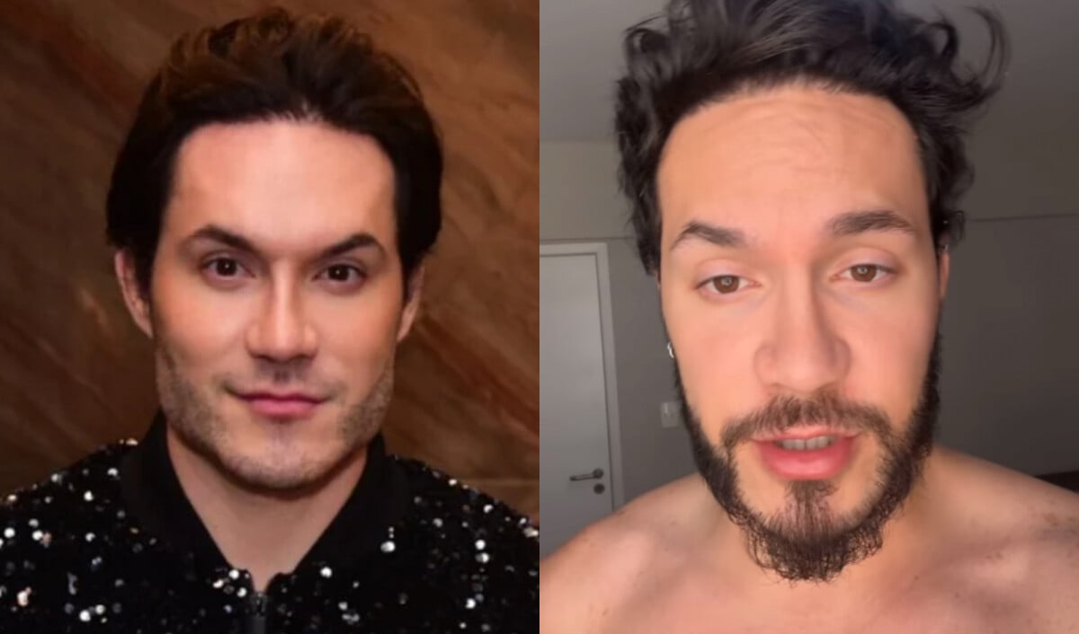 Foto: Ex-BBB Eliezer reverte harmonização facial e revela que Viih Tube ...