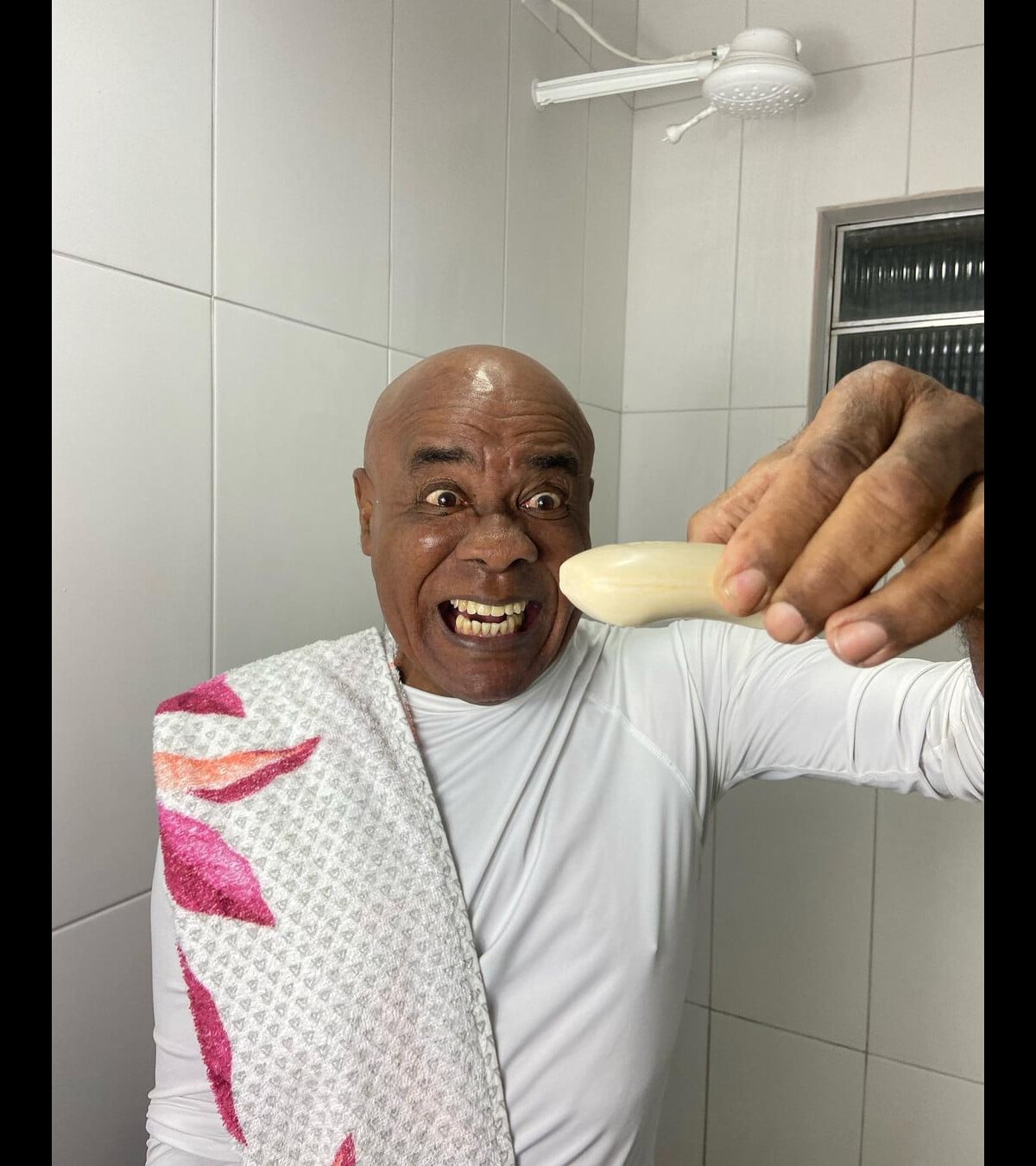 Foto: Kid Bengala: o processo é feito com preenchimento de ácido ...