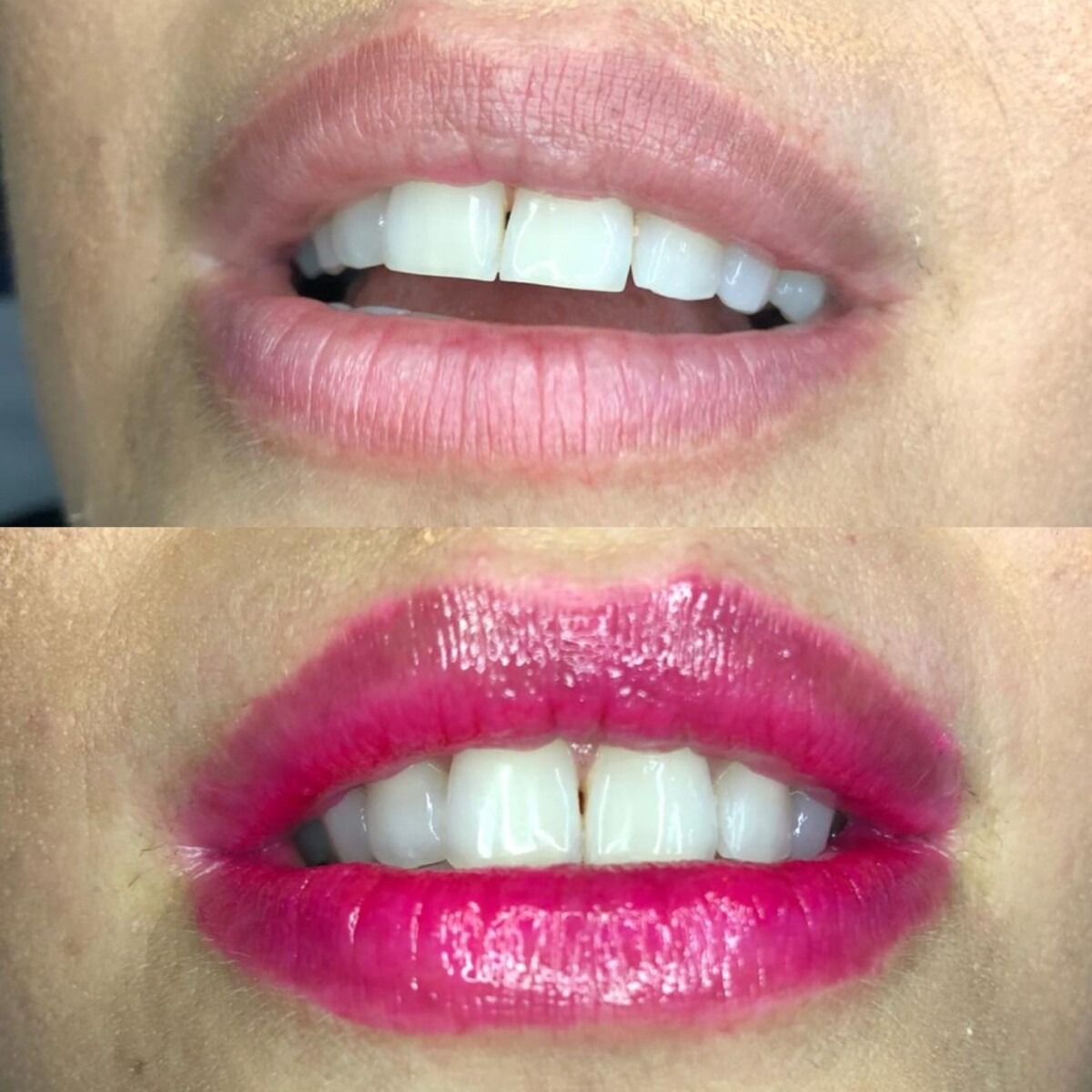 Foto: BB Lips: procedimento proporciona efeito lip tint, deixando os ...