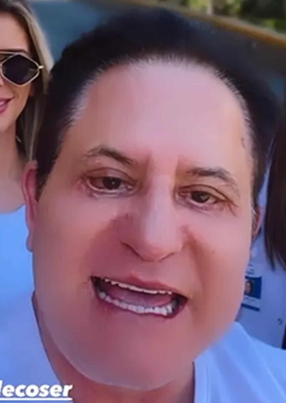 Foto: Cantor Marrone mostrou o resultado de uma série de procedimentos ...