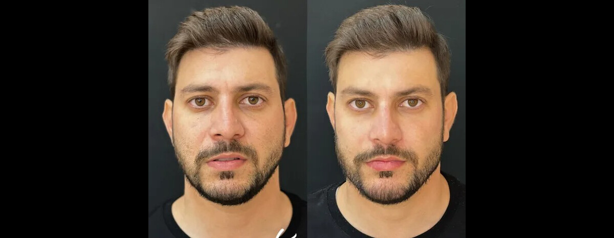Foto: O ex-BBB Caio Afiune está na lista de 'brothers' que realizaram ...