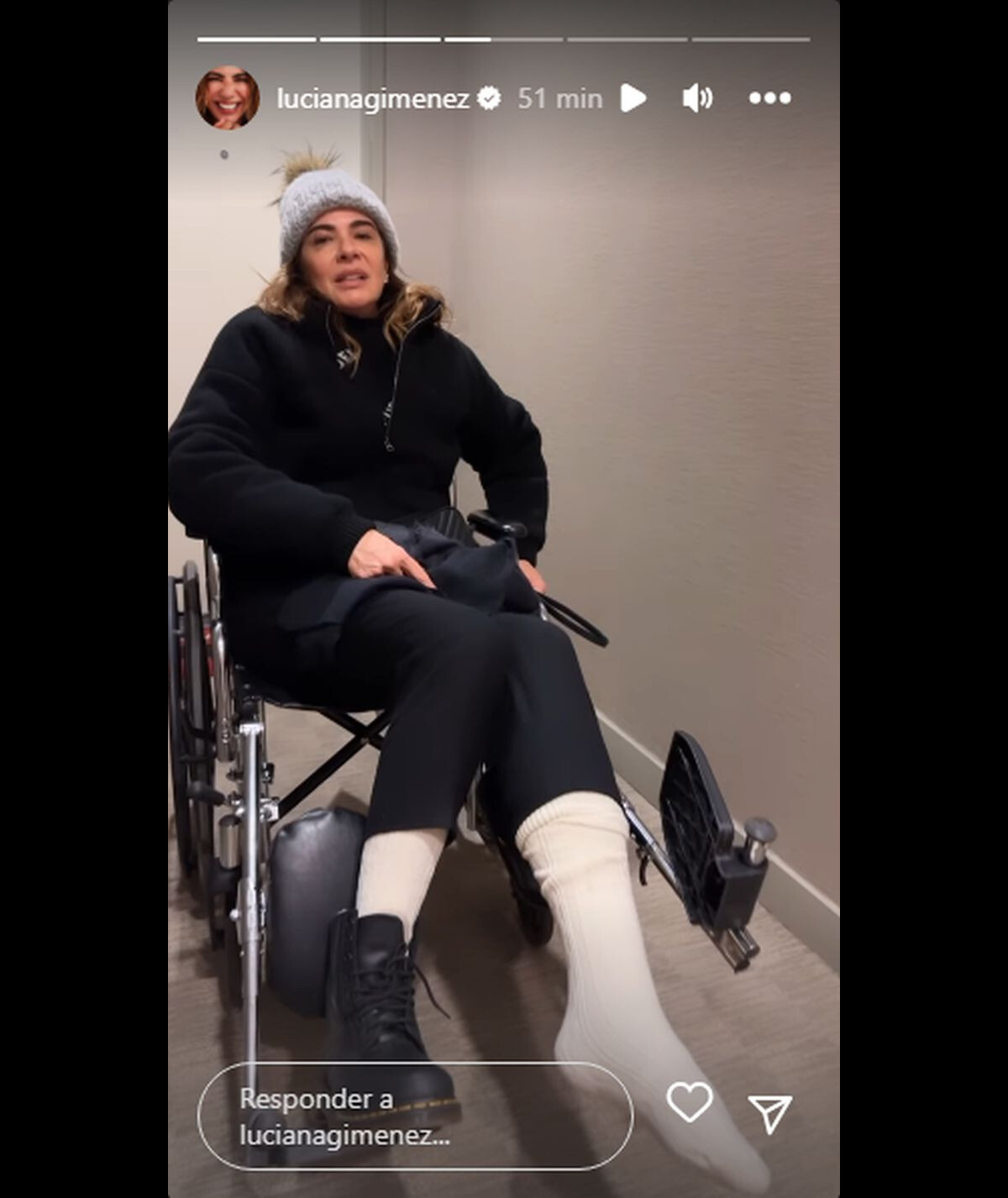 Foto: Luciana Gimenez quebrou a perna no acidente - Purepeople