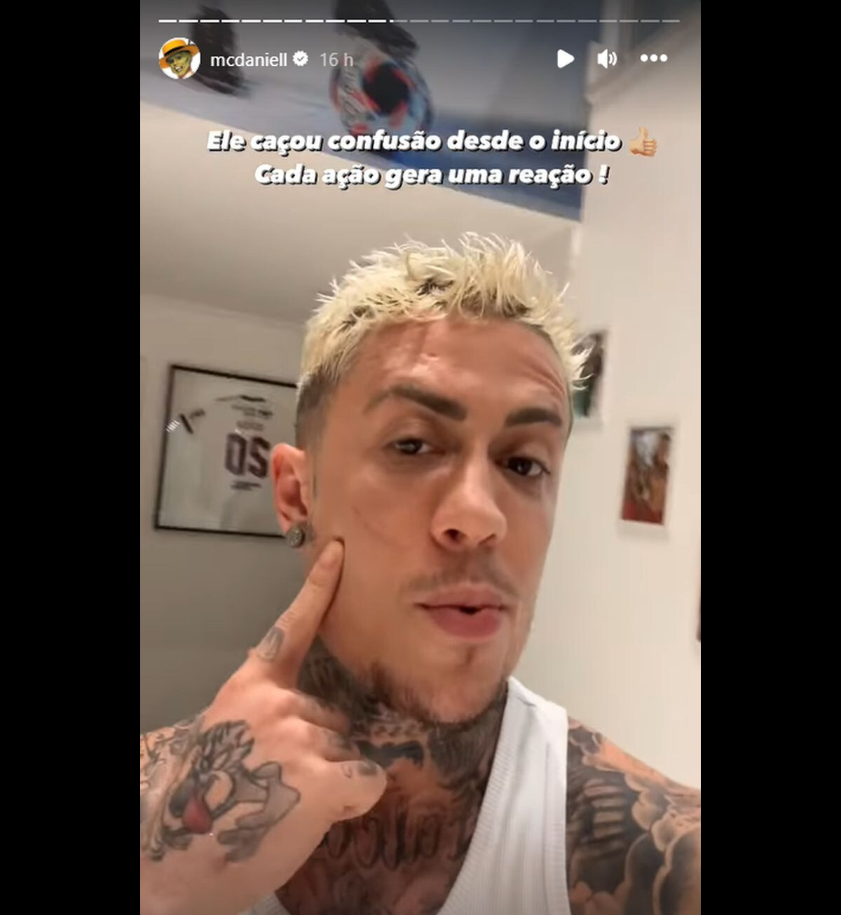 Foto: MC Daniel mostrou o rosto machucado após a briga - Purepeople