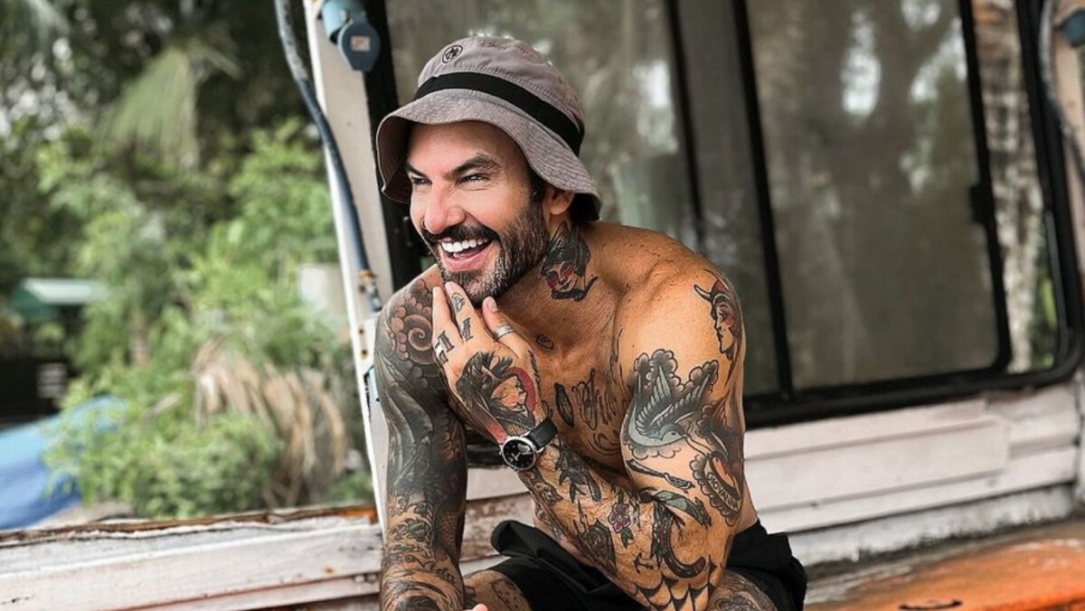 Foto: Ex-BBB Wagner Santiago detalha procedimento de harmonização ...