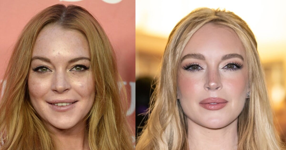 O que Lindsay Lohan fez no rosto? Transformação radical da atriz choca ...