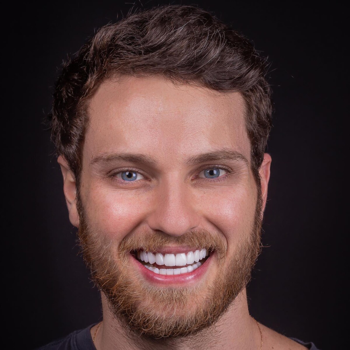 Foto: Lucas, namorado de Eslovênia, colocou lente nos dentes - Purepeople