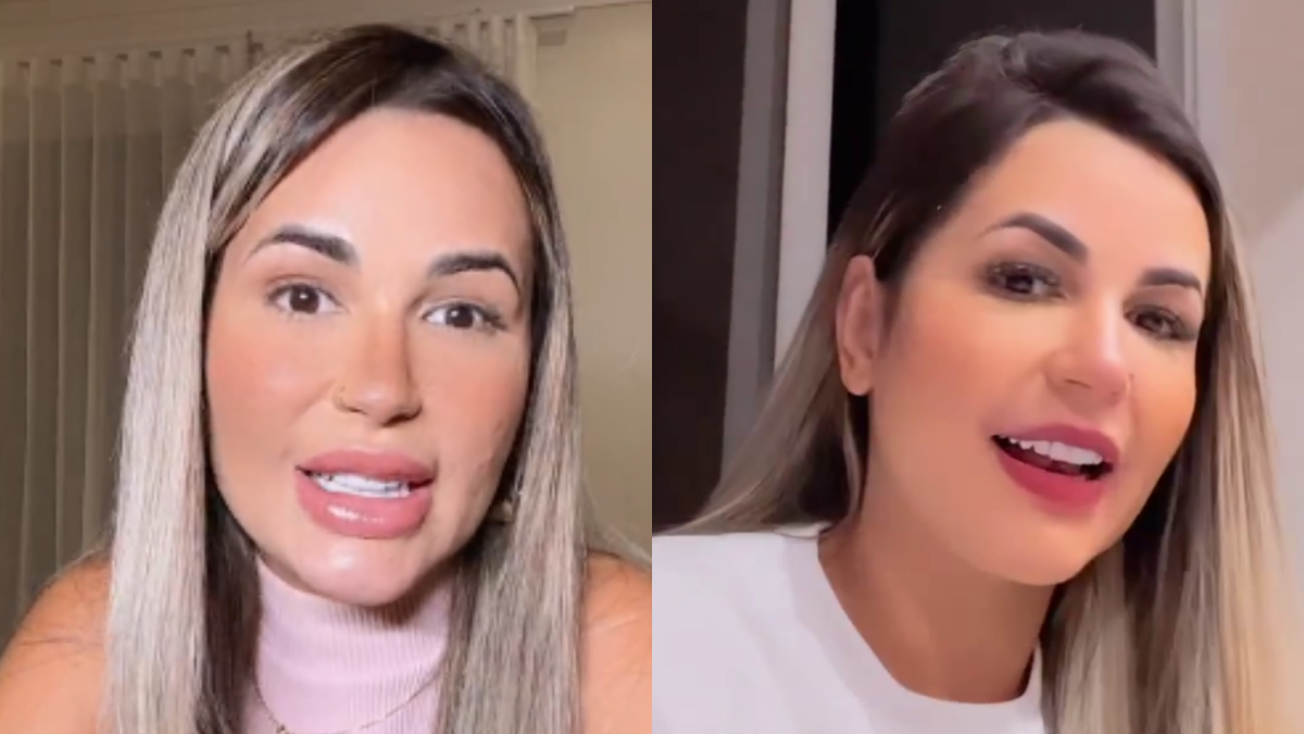 Foto: Deolane Bezerra retira preenchimento labial. Confira antes e ...