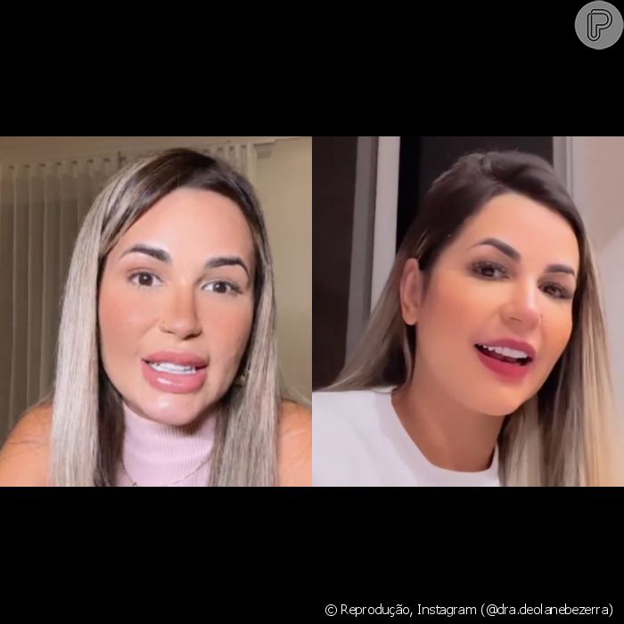 Deolane Bezerra retira preenchimento labial. Confira antes e depois ...