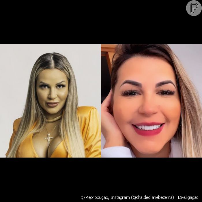 Antes e depois de Deolane Bezerra sem preenchimento labial - Purepeople