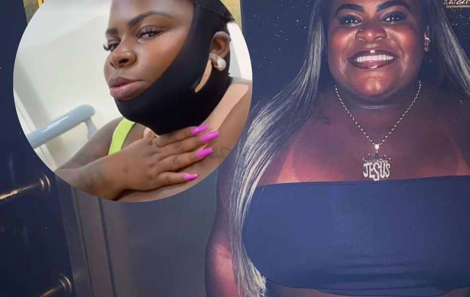 Jojo Todynho: cantora realiza procedimento no rosto e anuncia ...