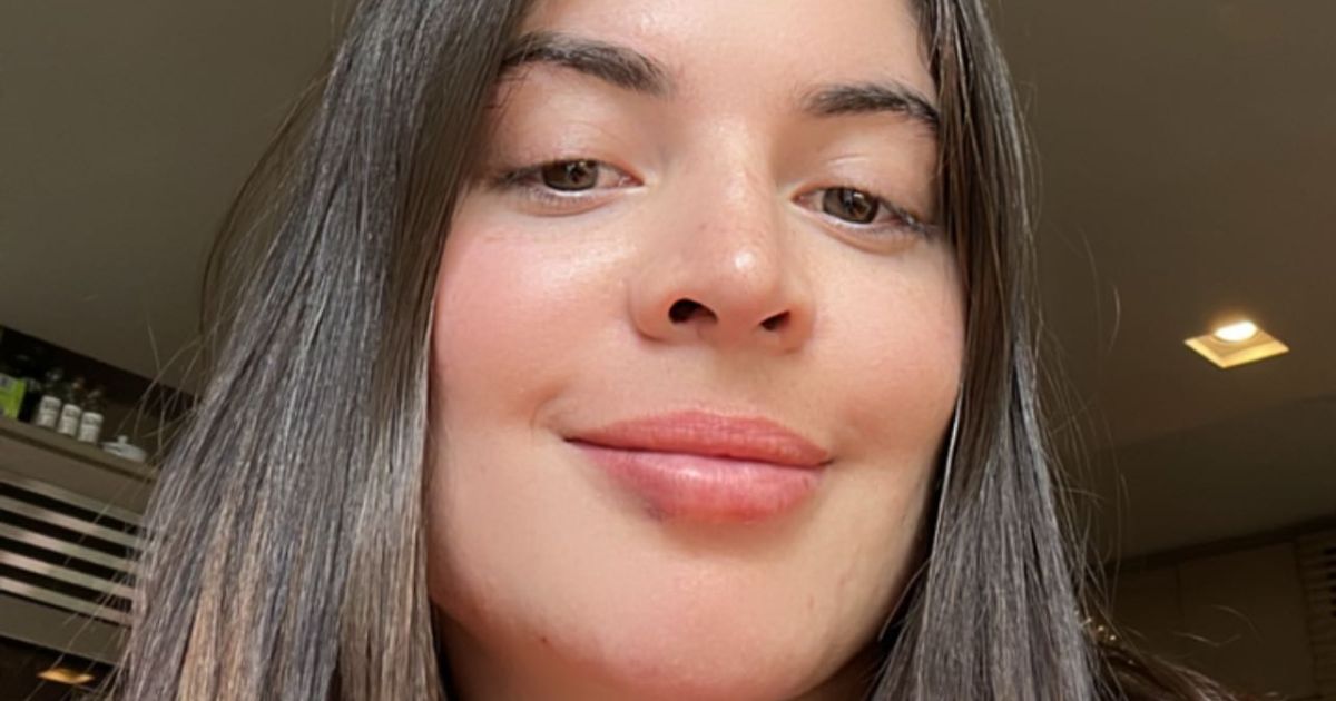 Gkay retirou parte do preenchimento labial em janeiro - Purepeople