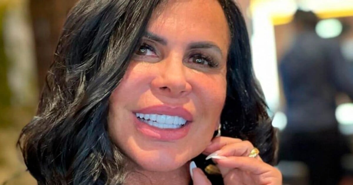 Gretchen se pronuncia após receber críticas por nova harmonização ...