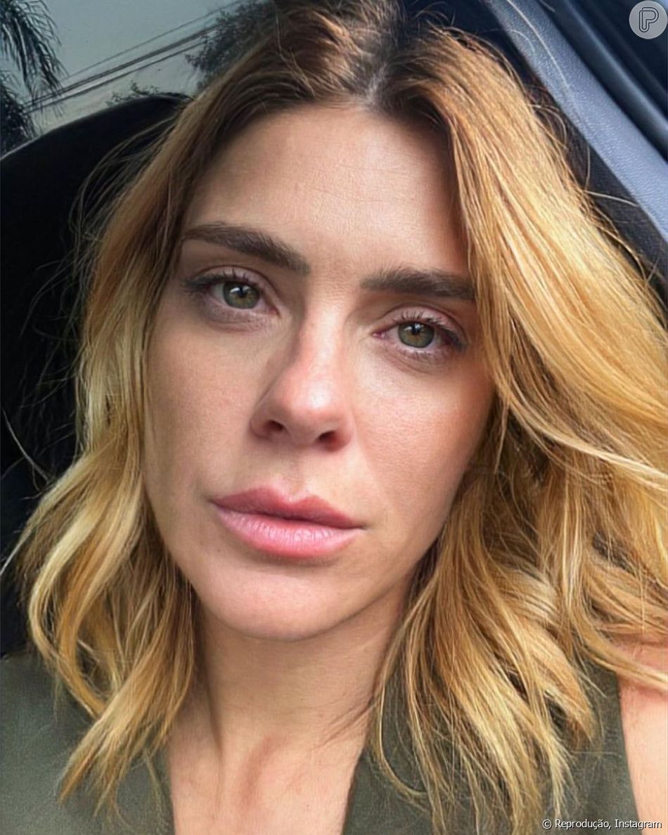 Carolina Dieckmann assume procedimento estético que deixa seu rosto ...