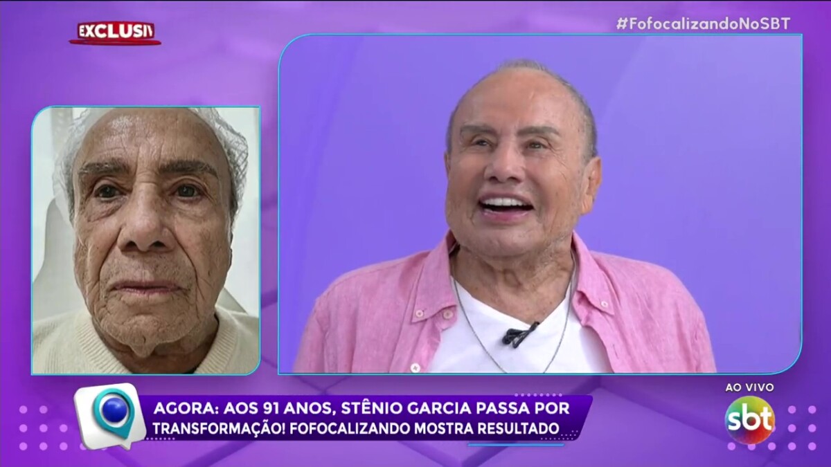 Foto: Stênio Garcia chamou a atenção recentemente ao fazer harmonização ...