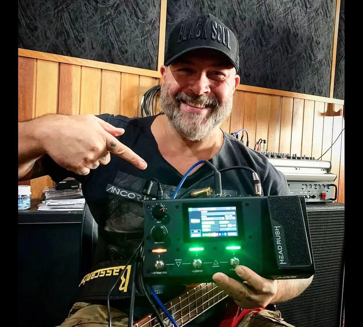 Foto: Mingau, do Ultraje a Rigor, levou um tiro na cabeça e bala ...