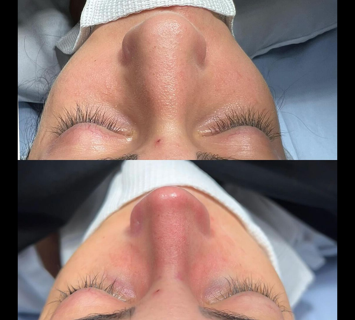 Foto: Ray Marcelle revelou que foi retirado uma parte da costela, que ...