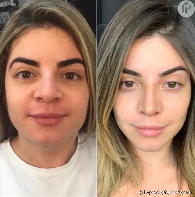 Gkay revela amor por plásticas e explica mudanças no corpo e rosto ...